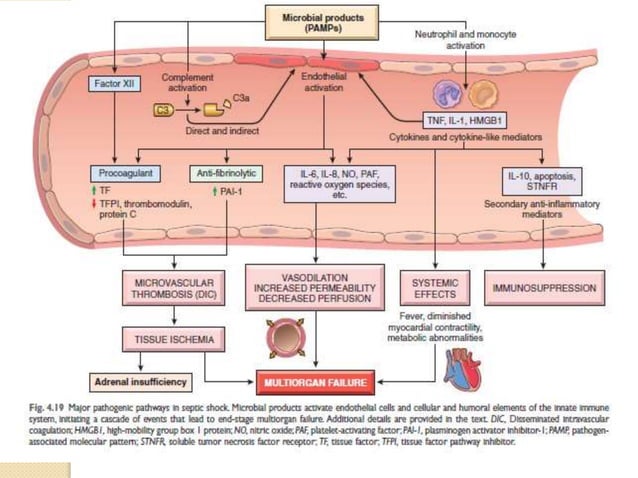 Pathology, Pathogenesis, Types of SHOCK.pptx | Heart and Cardiovascular Diseases | Diseases and ...