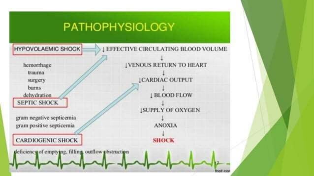 SHOCK.pptx definition types and classification | PPTX