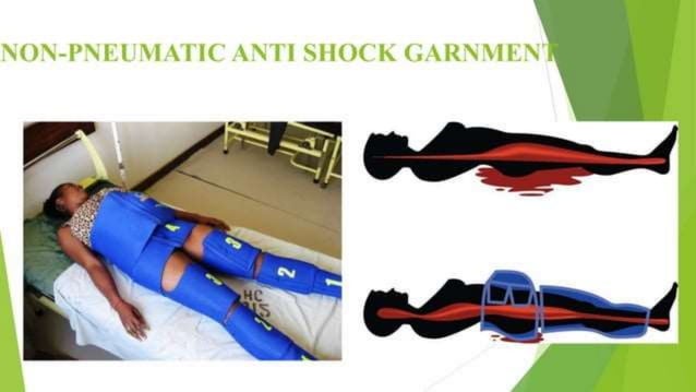 SHOCK.pptx definition types and classification | PPTX