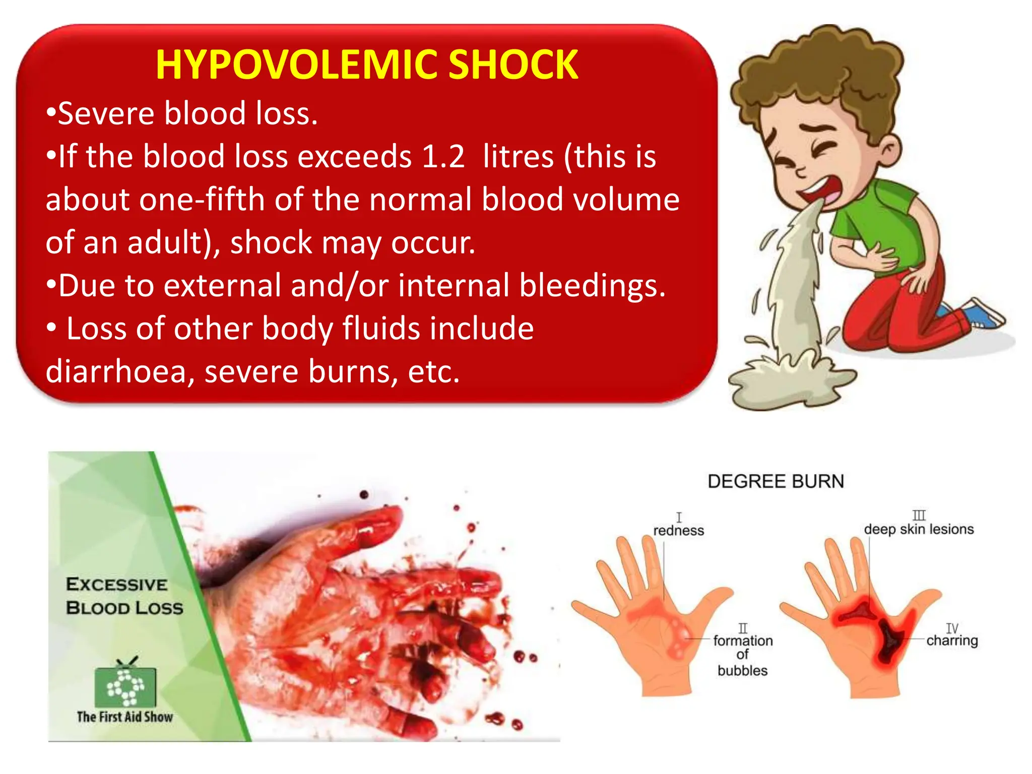 First aid for Shock - Nursing students.pptx