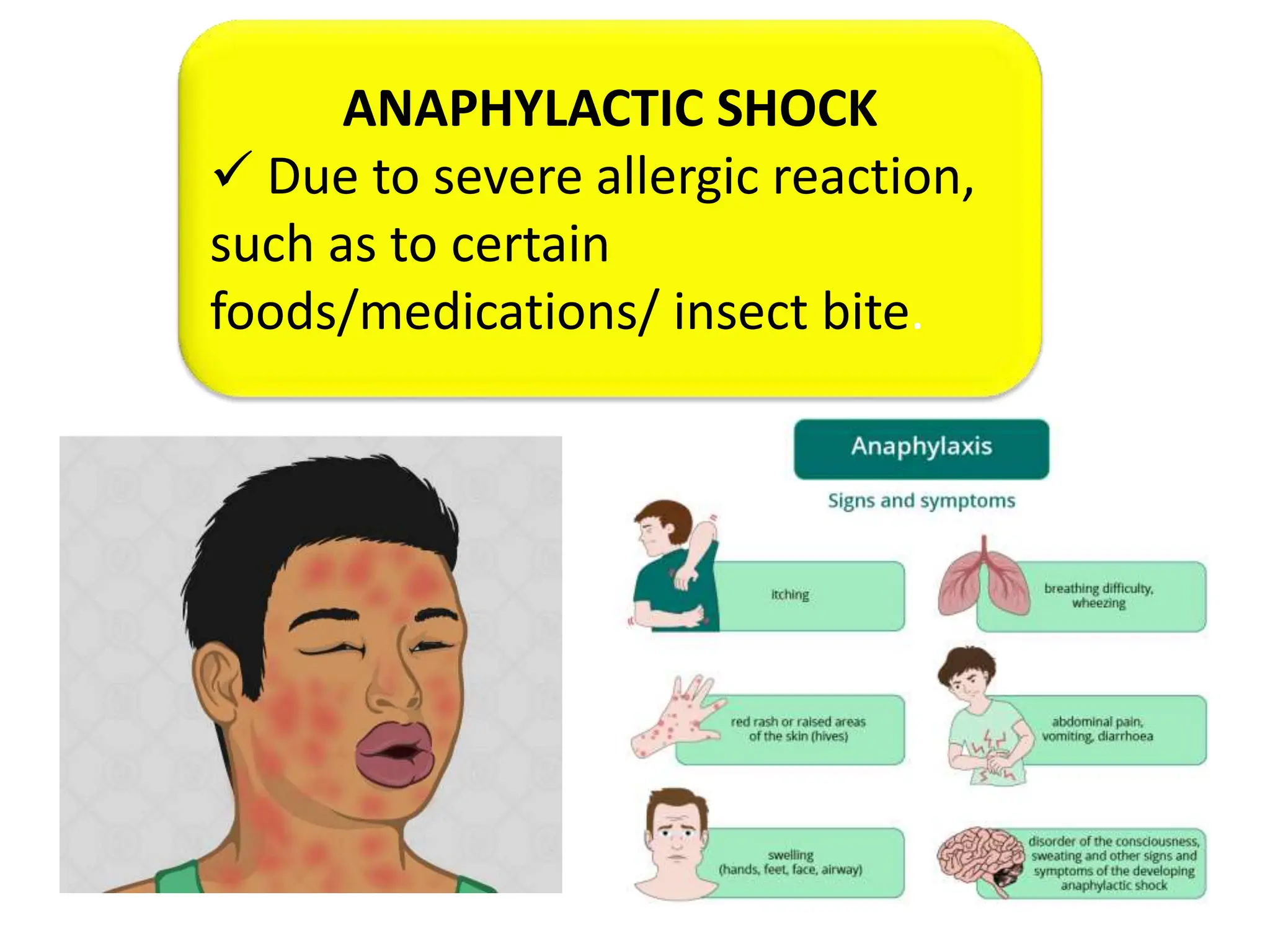 First aid for Shock - Nursing students.pptx
