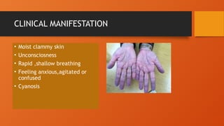 SHOCK,classification, etiology,management, for dental students | PPTX