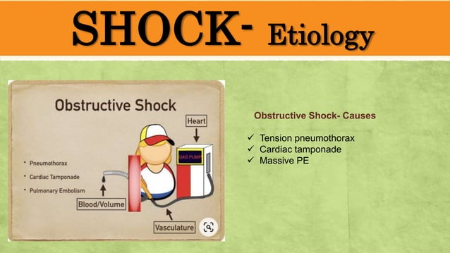 SHOCK- Basic Principles in Surgery.pptx