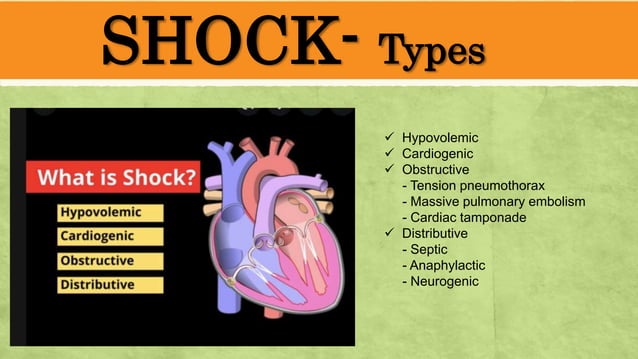 SHOCK- Basic Principles in Surgery.pptx