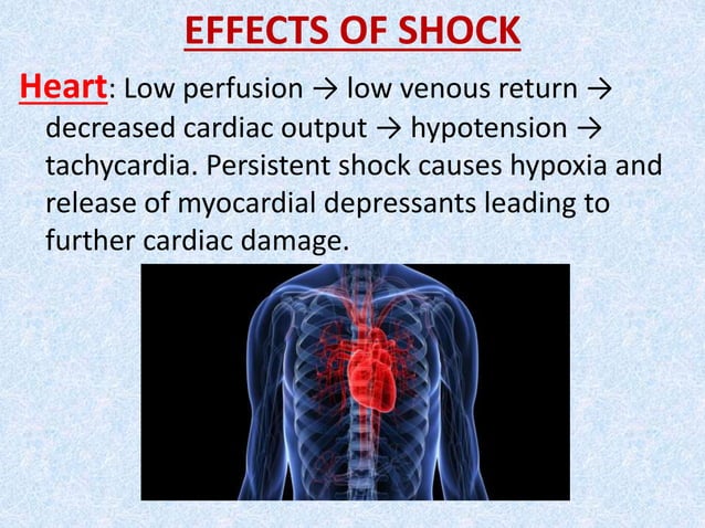 SHOCK - PATHOPHYSIOLOGY, TYPES, APPROACH, TREATMENT. | PPTX