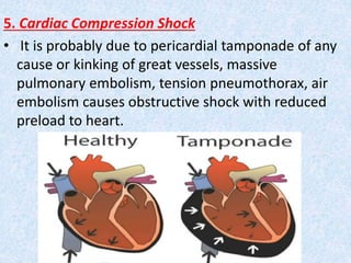 SHOCK - PATHOPHYSIOLOGY, TYPES, APPROACH, TREATMENT. | PPTX