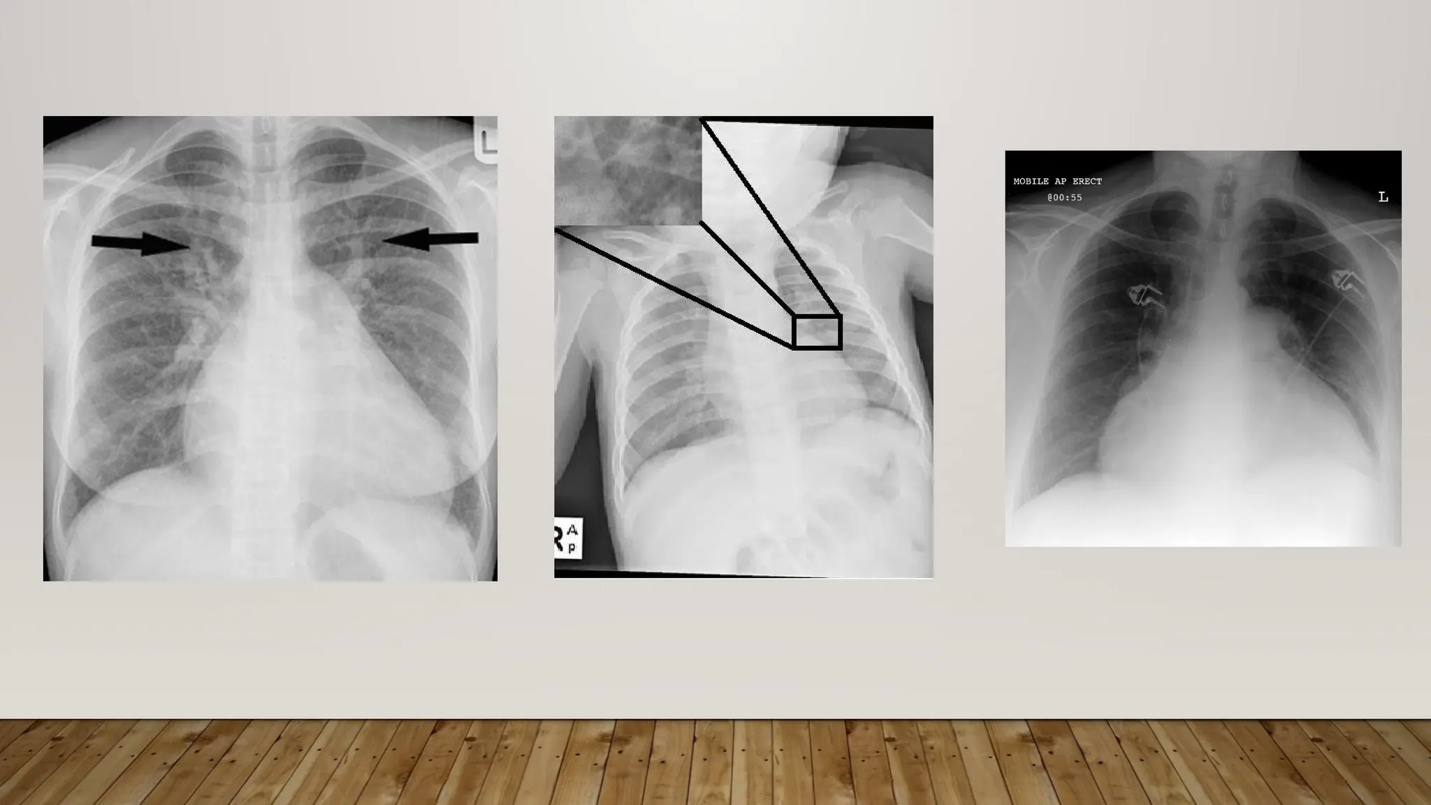 shock - harrison-all types, classification, pathophysiology.pptx