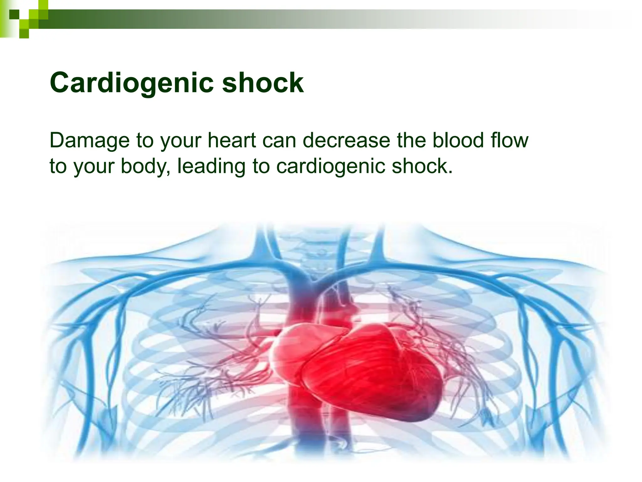 shock-ppt.pptx