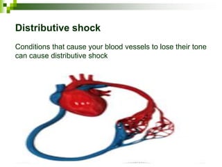 shock-ppt.pptx