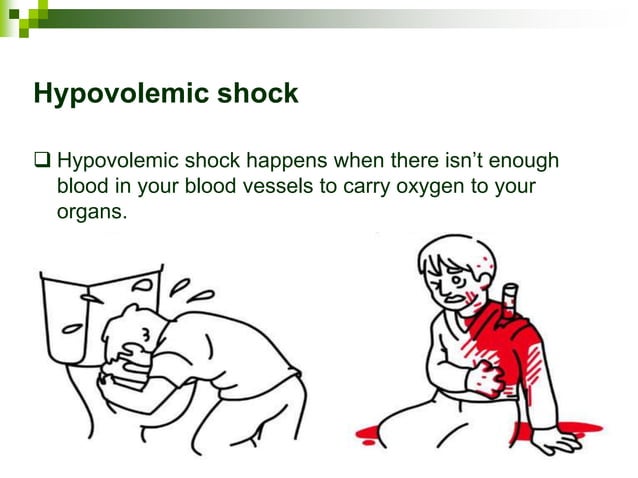 shock-ppt.pptx