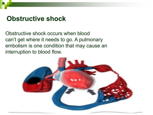 shock-ppt.pptx