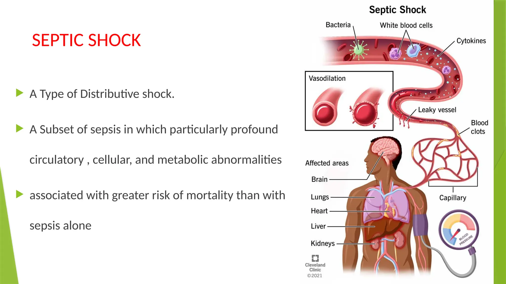 SHOCK - presentation and management -PPT (1).pptx