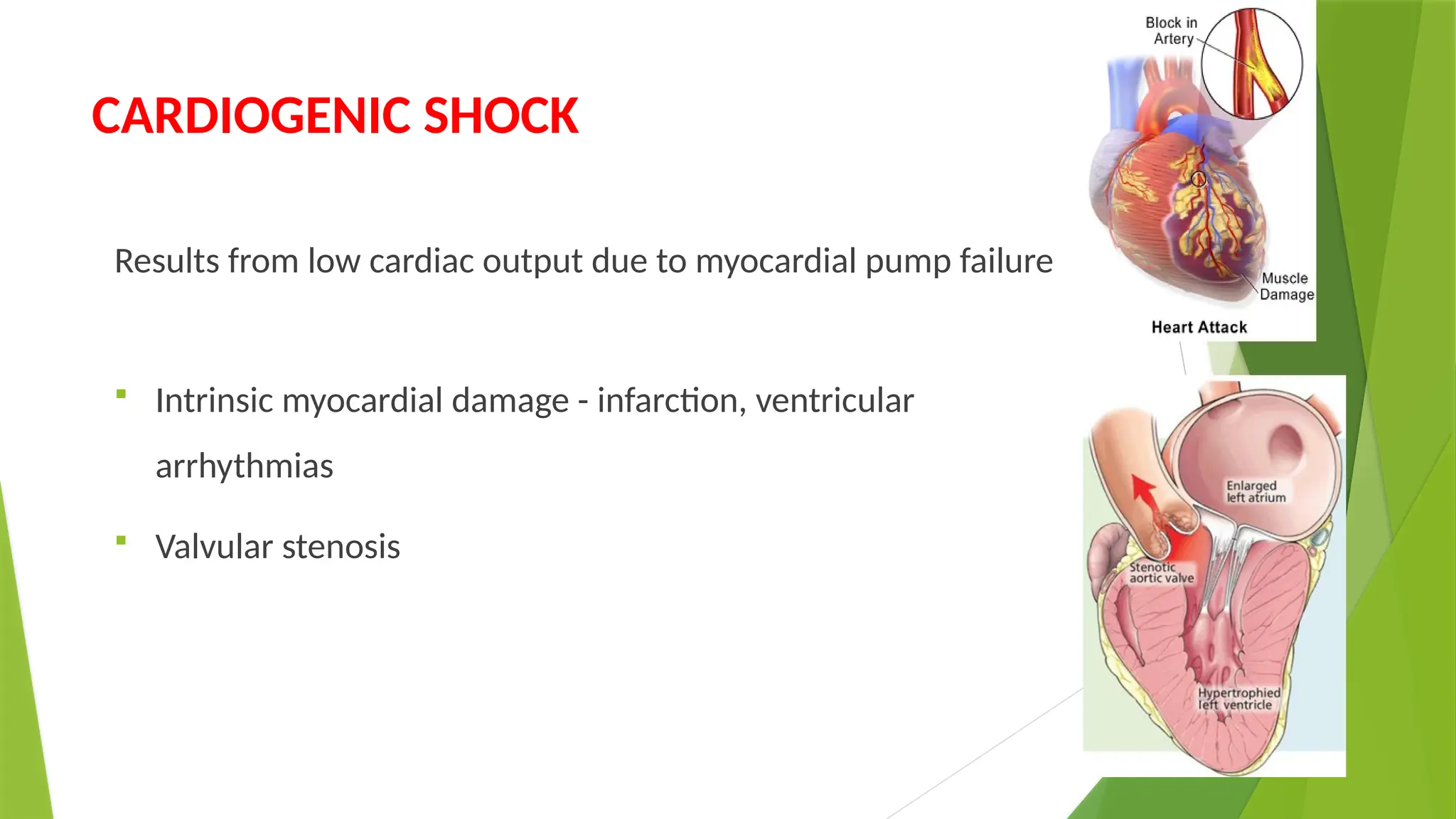 SHOCK - presentation and management -PPT (1).pptx