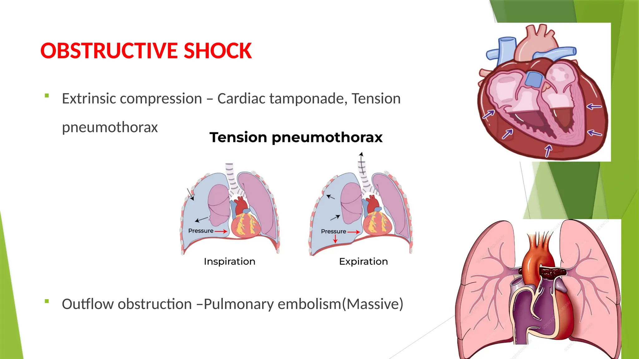 SHOCK - presentation and management -PPT (1).pptx