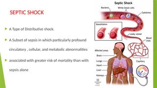 SHOCK - presentation and management -PPT (1).pptx