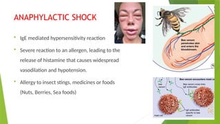 SHOCK - presentation and management -PPT (1).pptx