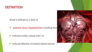 SHOCK - presentation and management -PPT (1).pptx