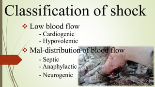 Shock - Presentation by us (Rivin,Dhara,Arun) | PPTX