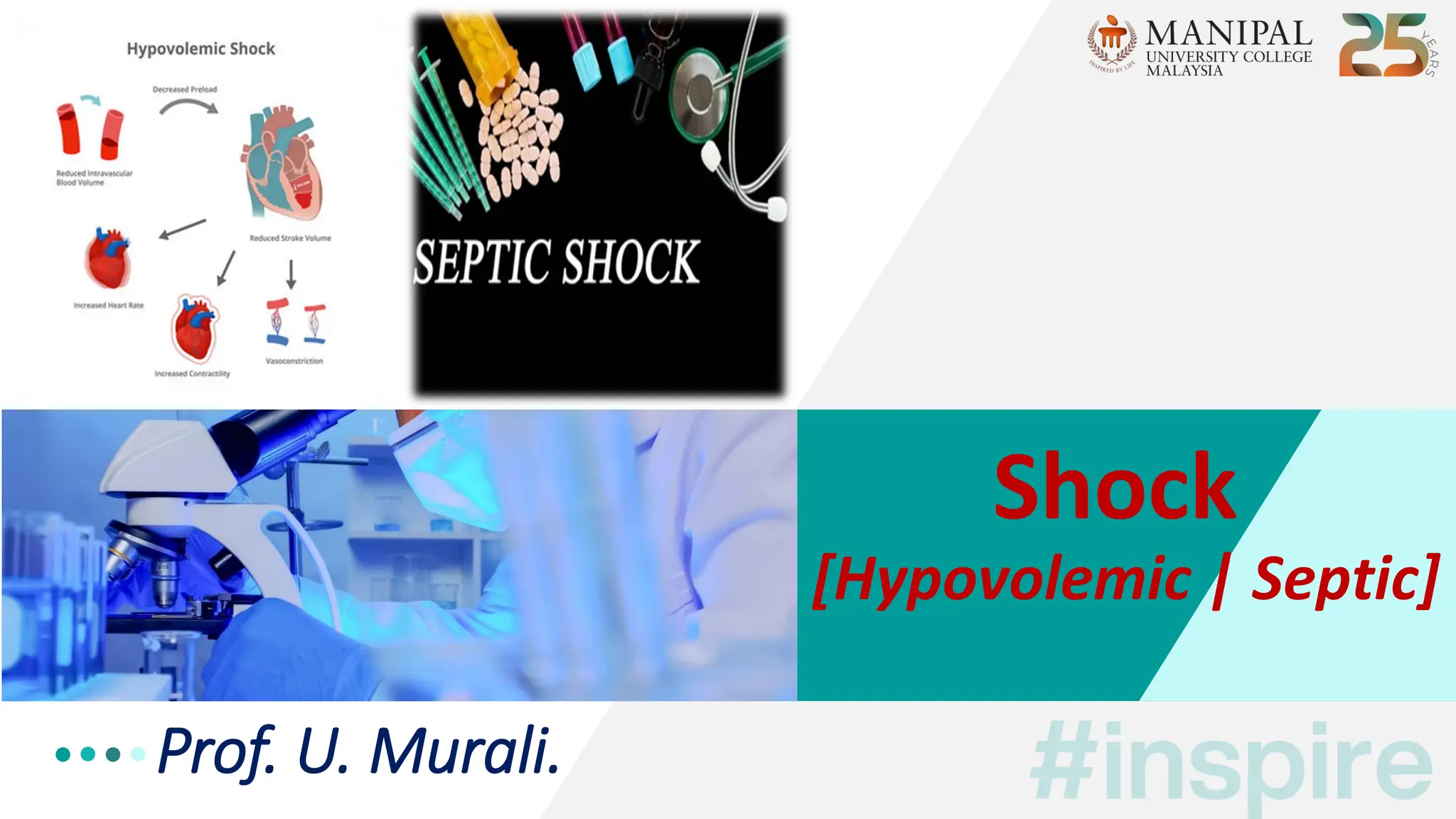 Shock - Septic + Hypovolemic - Causes & Management | PDF | First Aid ...