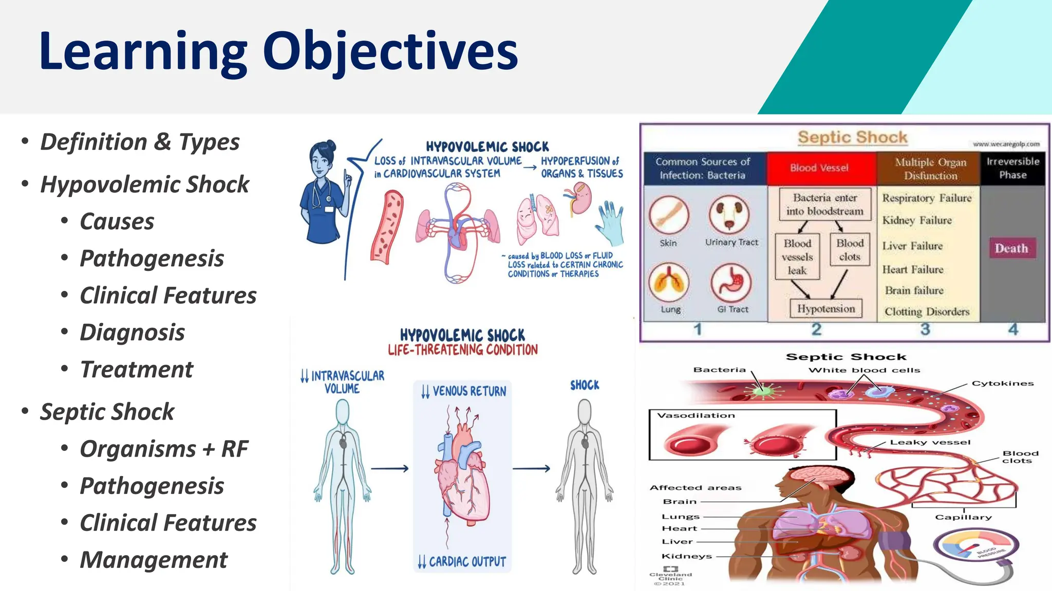 Shock - Septic + Hypovolemic - Causes & Management | PDF