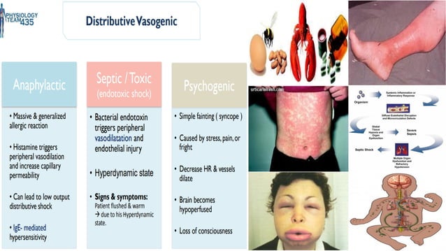 Shock - Septic + Hypovolemic - Causes & Management | PDF | First Aid ...