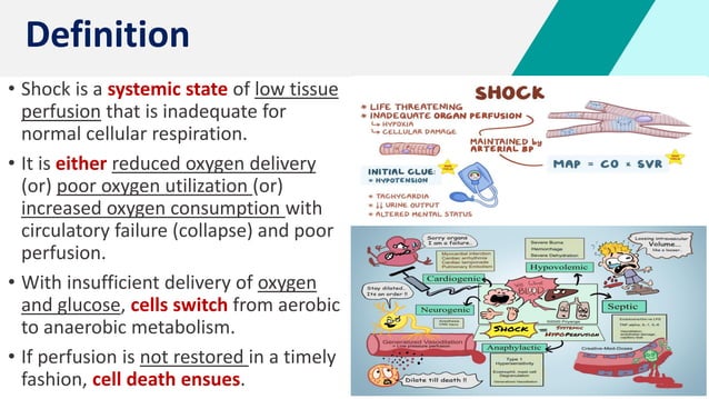 Shock - Septic + Hypovolemic - Causes & Management | PDF | First Aid ...