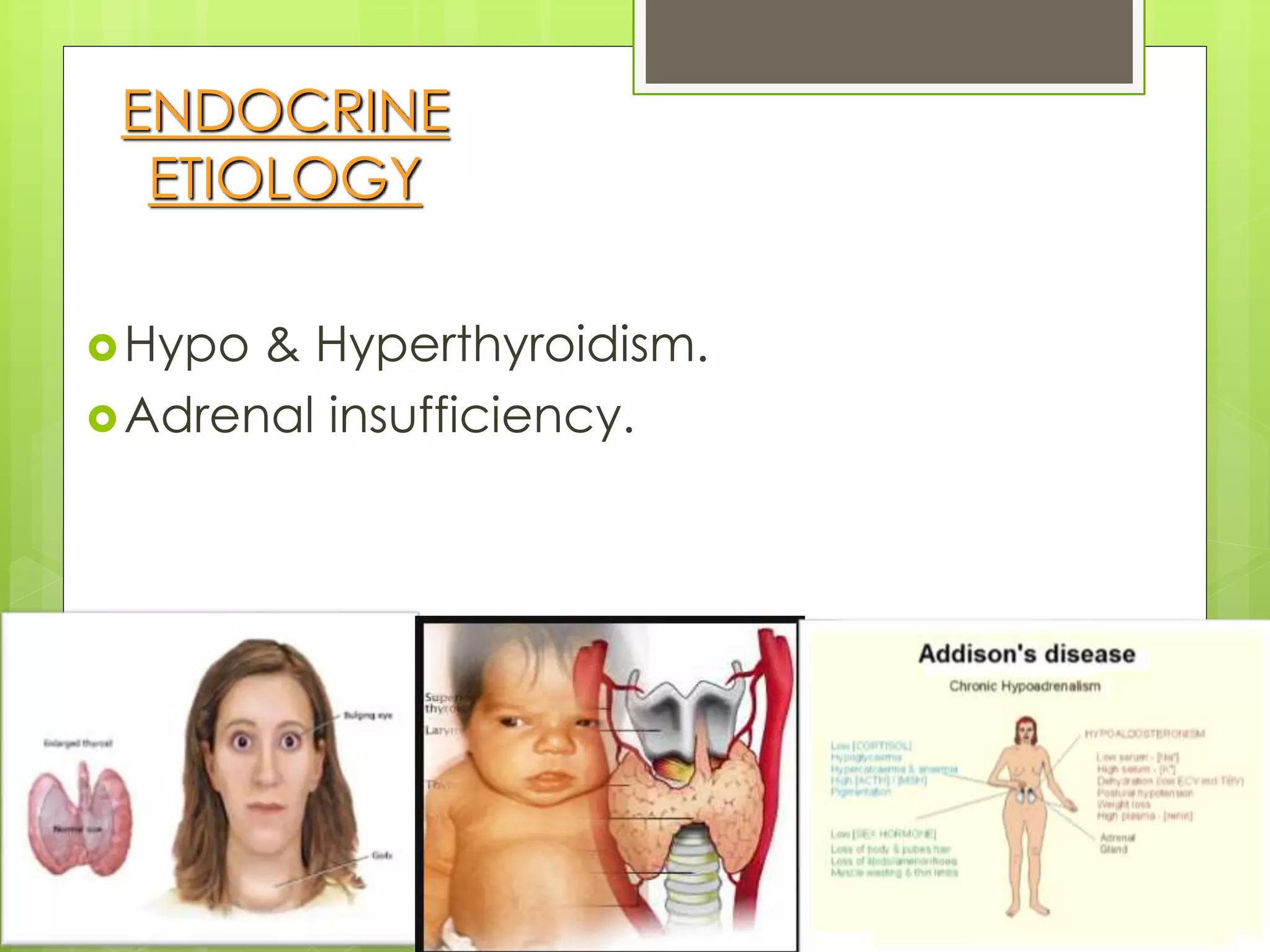 Shock - Pathophysiology / Types & Management | PPTX