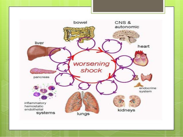 Shock - Pathophysiology / Types & Management