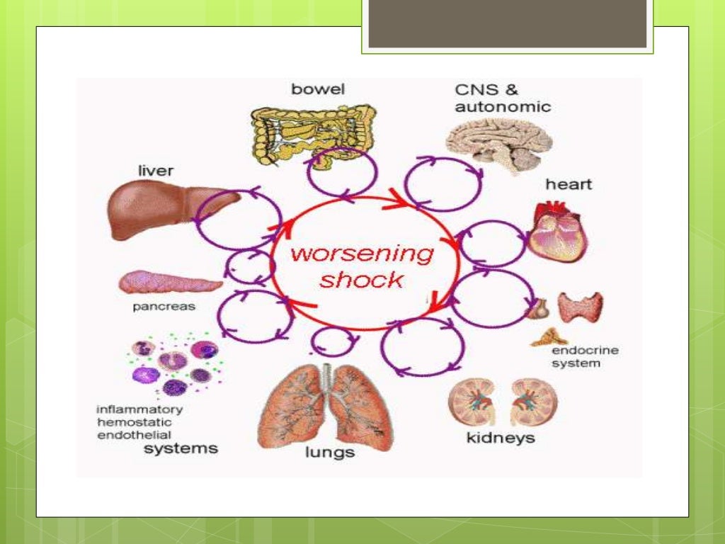 Shock Pathophysiology Types Management - vrogue.co Shock Pathophysiology Types Management - vrogue.co