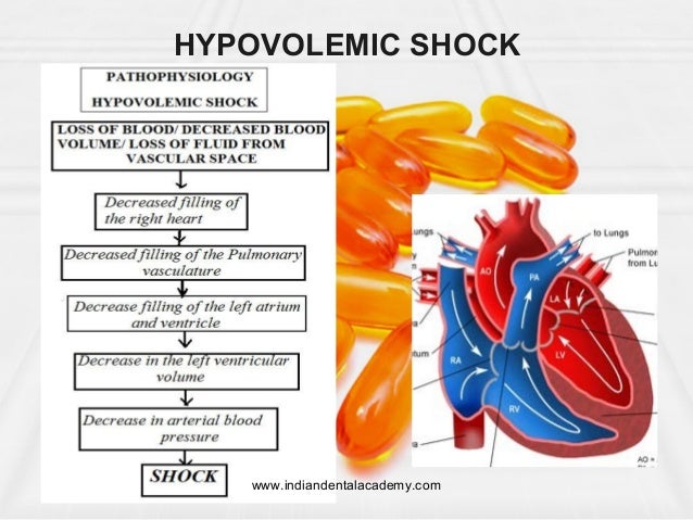 Shock and its management final/ dental implant courses