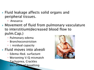 Shock and mods | PPTX