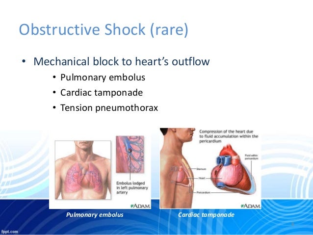 haemorrhagic shock