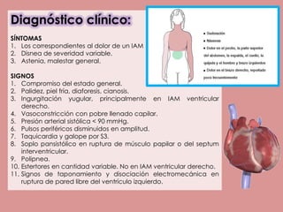 Shock cardiogenico | PPTX