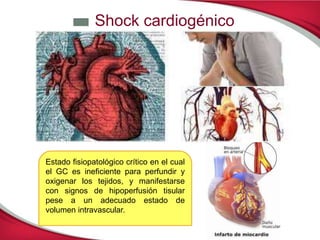 SHOCK CARDIOGENICO (2).pptx