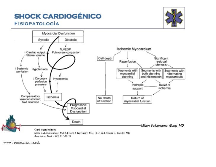 Shock cardiogénico