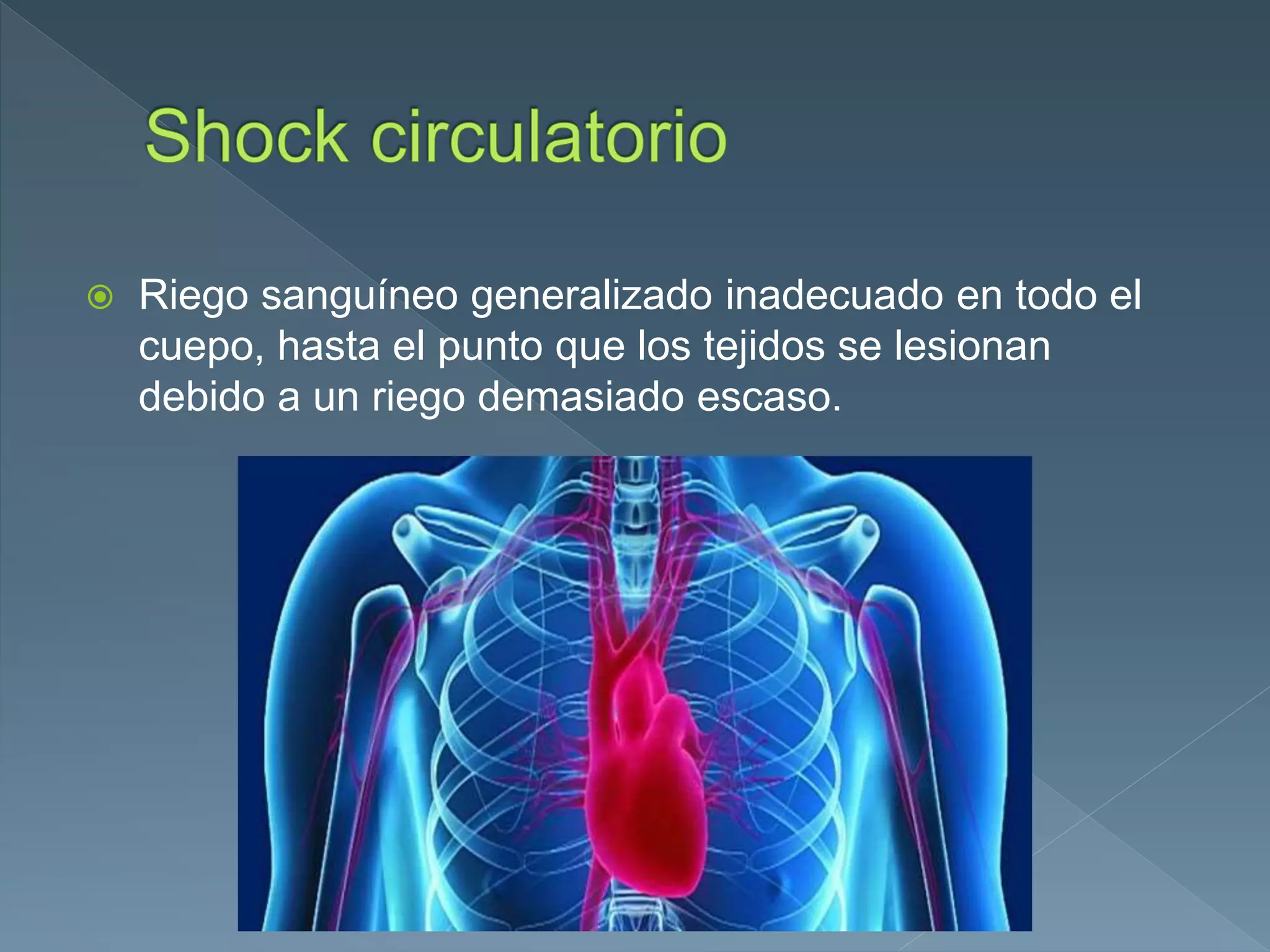 Shock circulatorio | PPT
