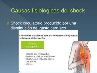 Shock circulatorio | PPTX