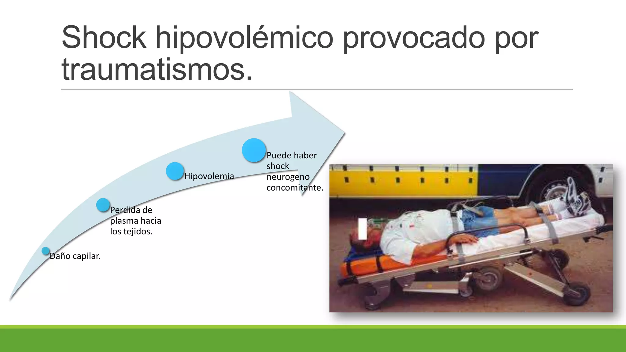 Shock circulatorio y fisiología de su tratamiento. | PPT