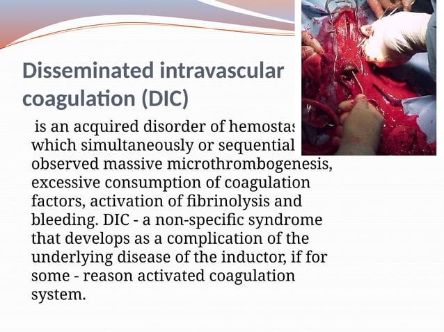 Shock DIC Embolism gynecology and obstetrics | PPT