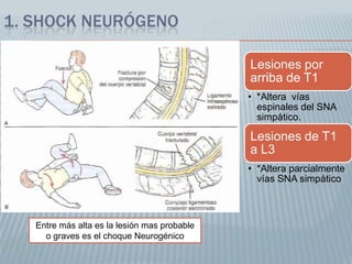 Shock distributivo | PPTX