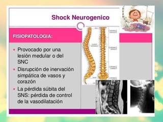 Shock distributivo | PPTX