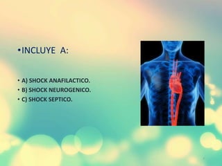 Shock distributivo | PPTX