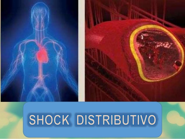 Shock distributivo