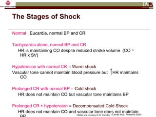 Shock in children-revppt | PPT | First Aid | Injuries