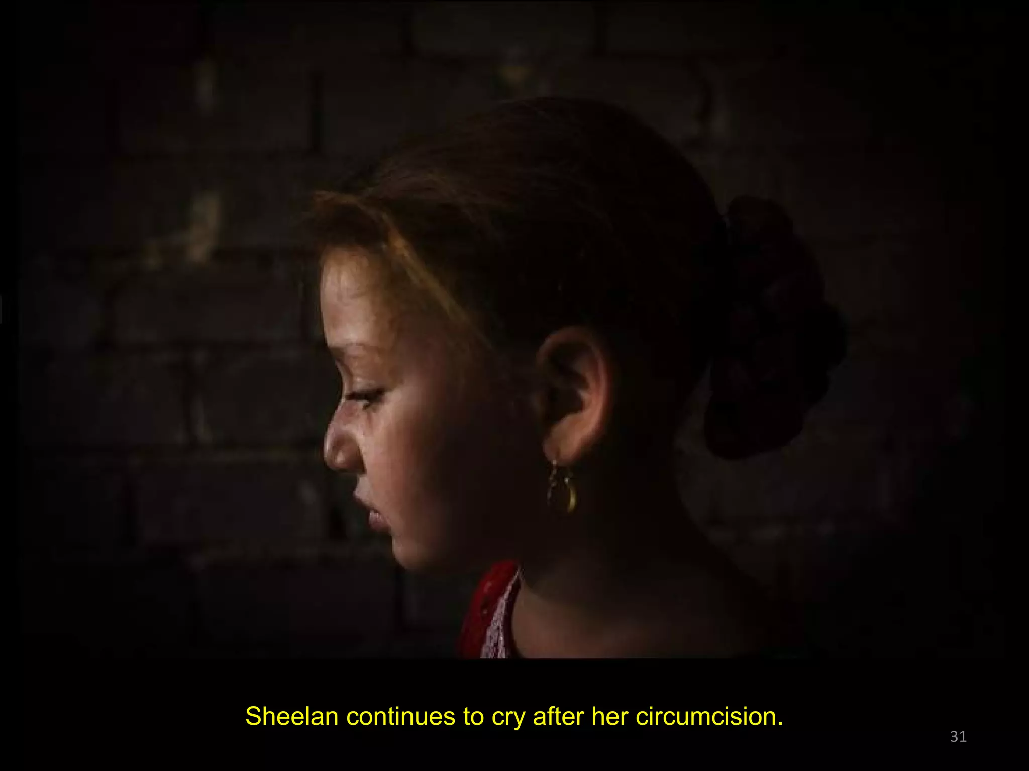 Shocking Female Genital Mutilation Aka Female Circumcision Ppt