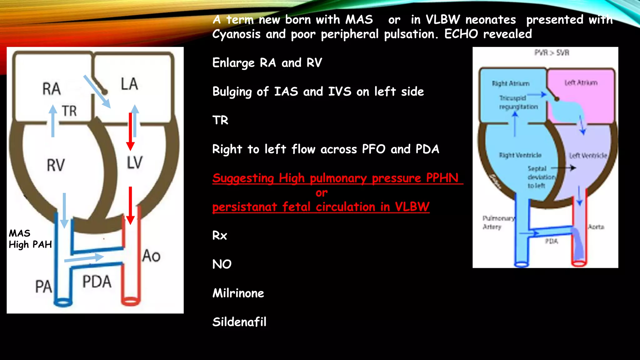 Shock in neonate nov 2020 | PDF