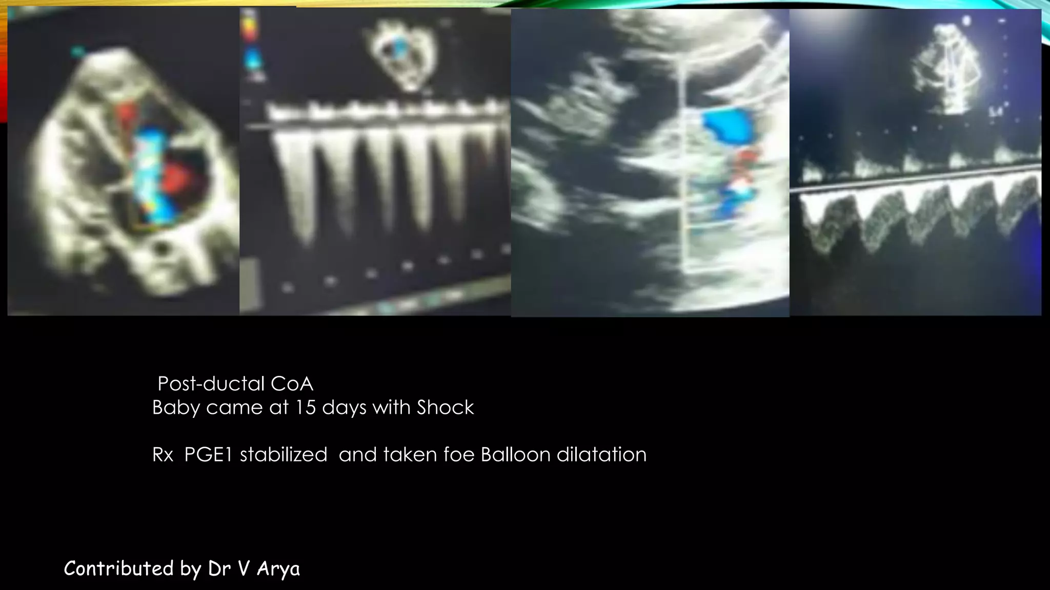 Shock in neonate nov 2020 | PDF