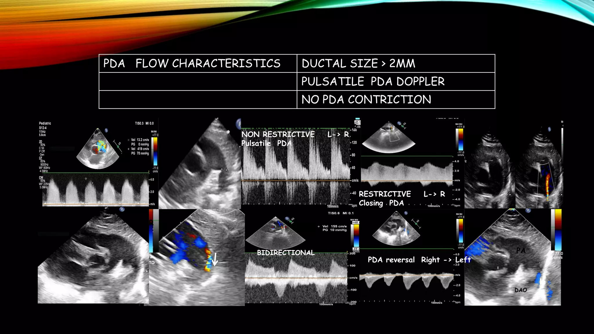 Shock in neonate nov 2020 | PDF