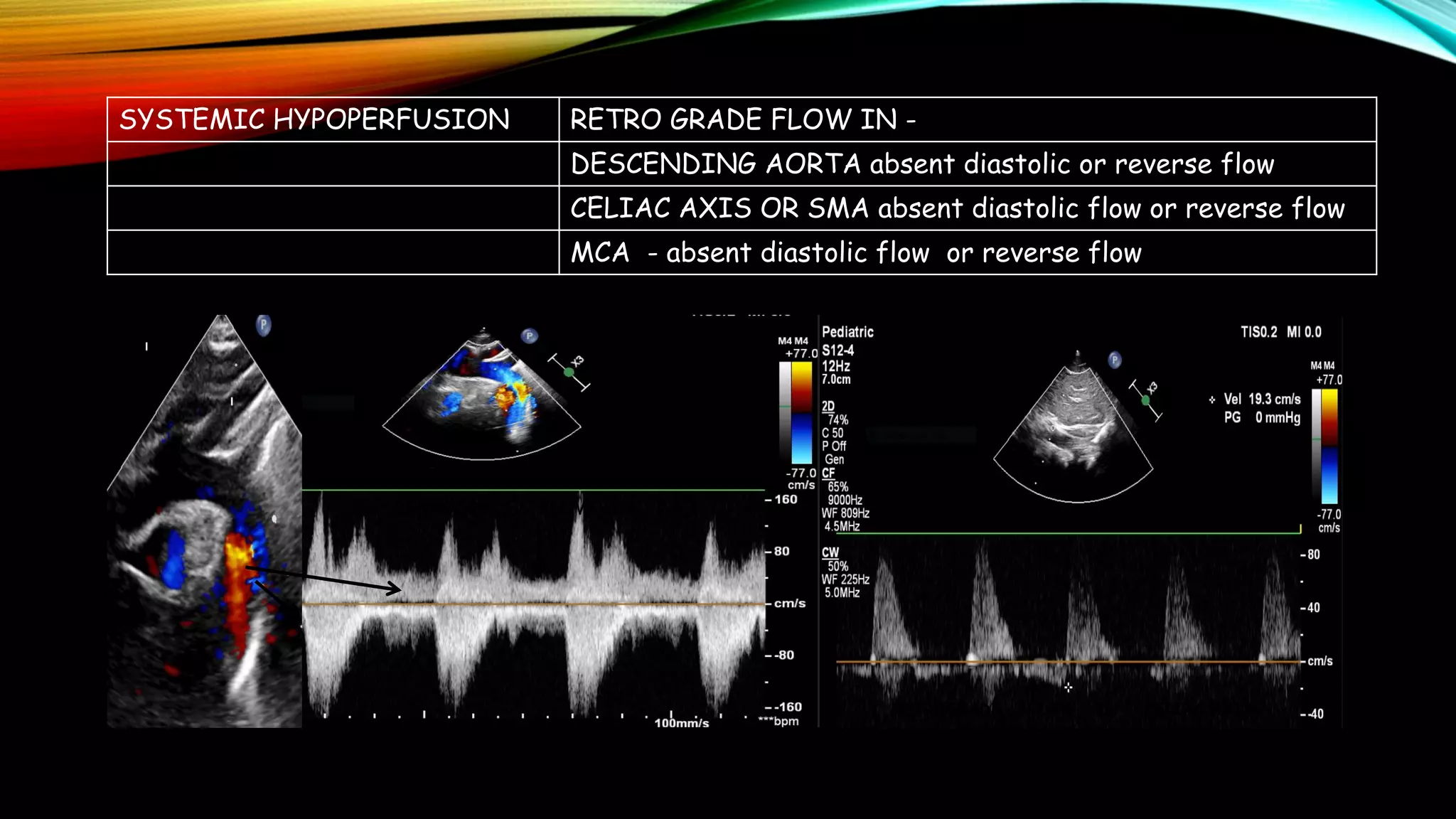 Shock in neonate nov 2020 | PDF