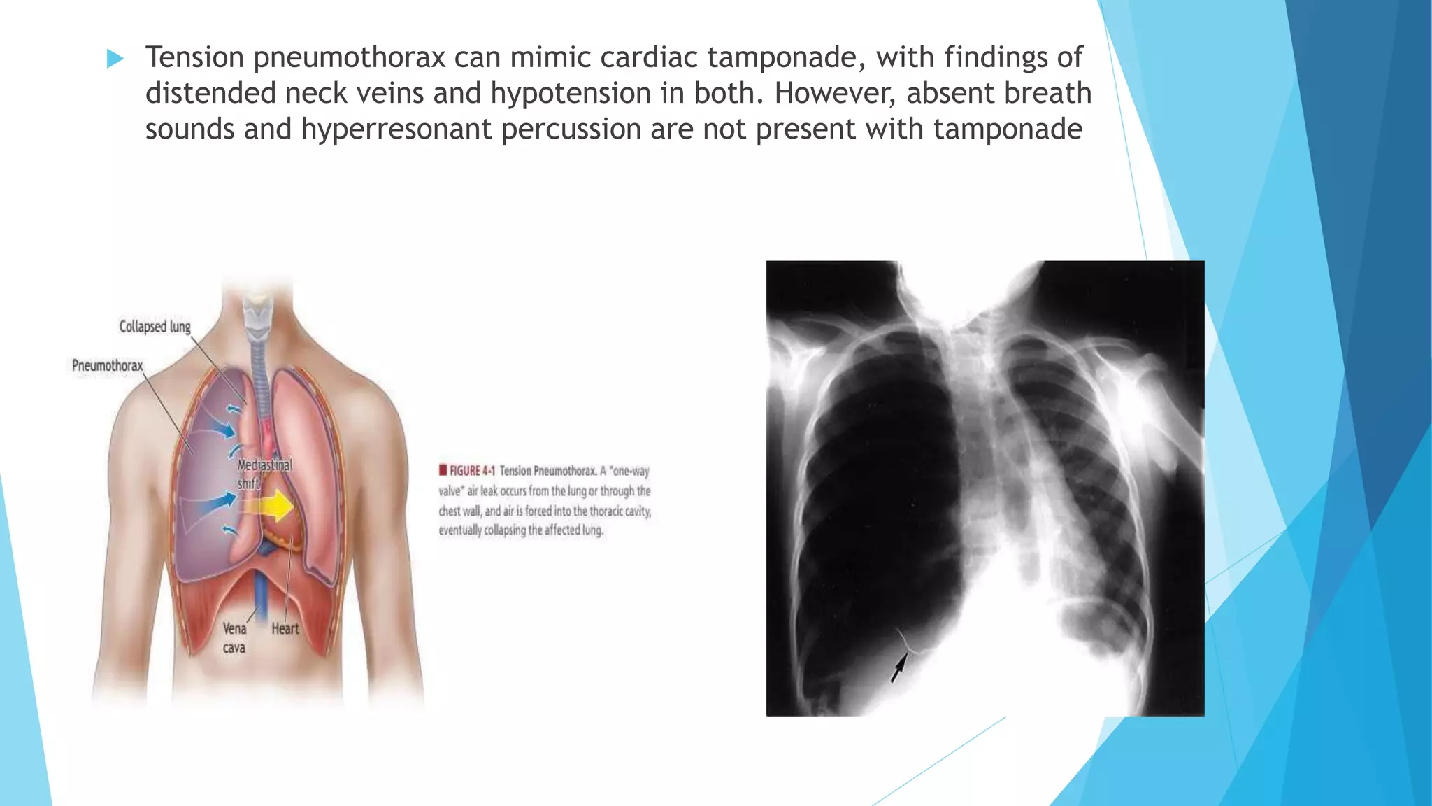 Shock in Trauma.pptx